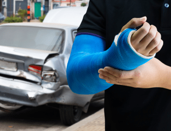 Bone Fractures in Car Accidents - Denlea & Carton LLP